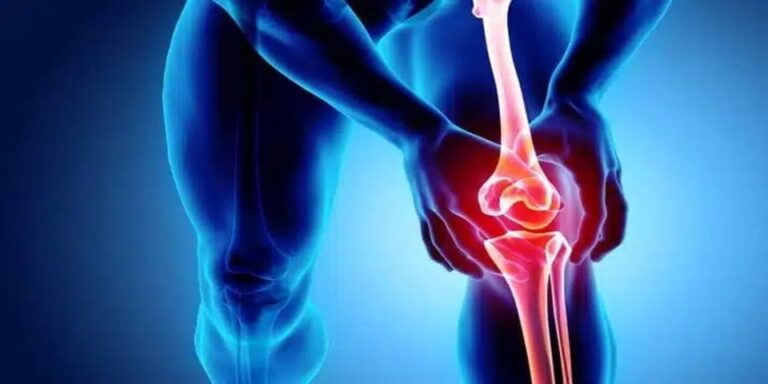 Natural Remedies for Knee Pain in Old Age – Dr. Ashwini Gaurav